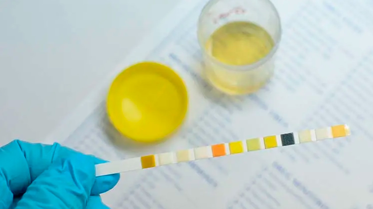 congreso-internacional-uroanalisis | Citem Chile